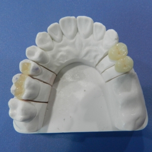 Dental Lab China – Glisten Dental Lab